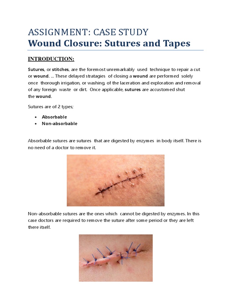 Case Study On Wound Healing | PDF | Wound Healing | Healing