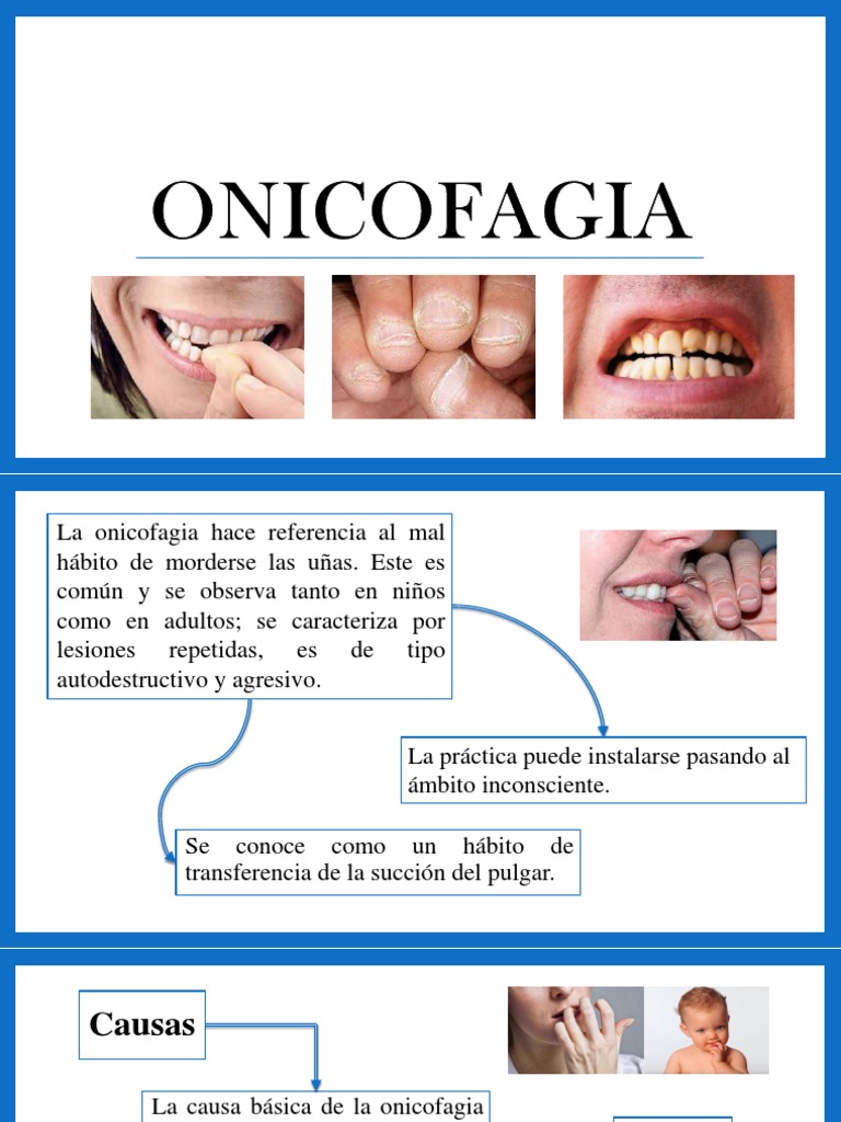 Onicofagia: causas y tratamientos | PDF