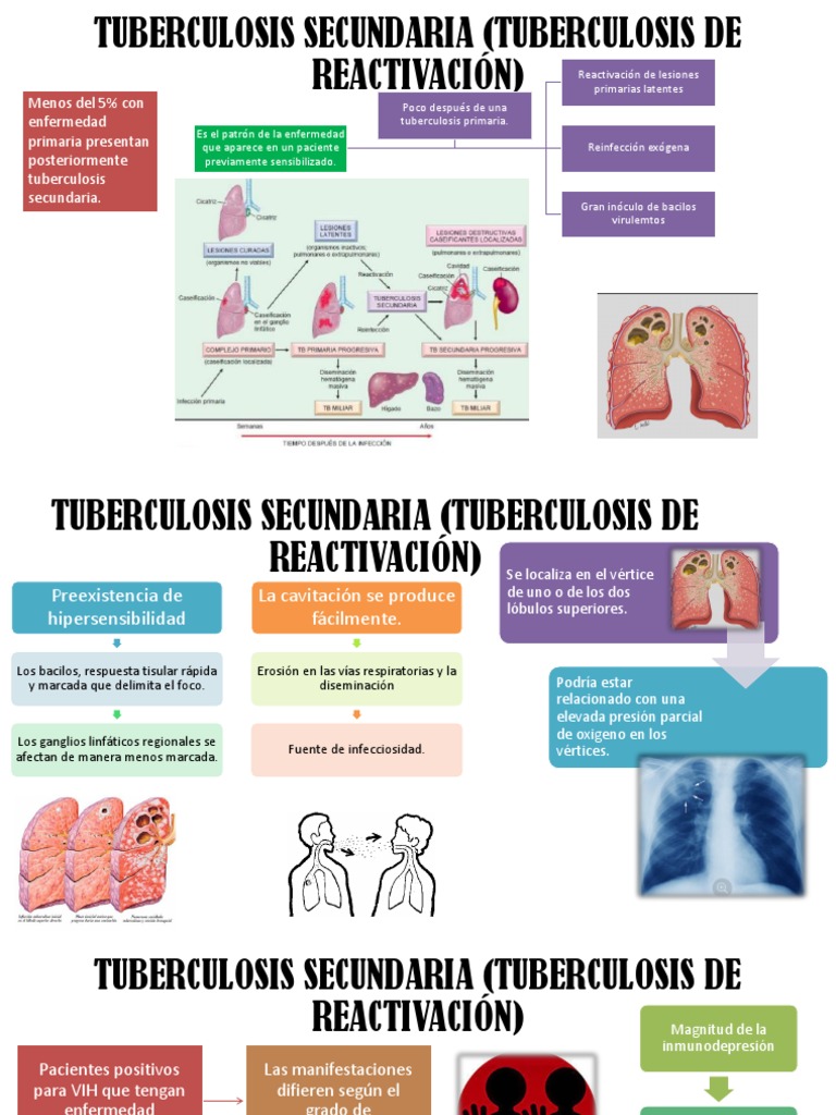 Tuberculosis Secundaria | PDF | Tuberculosis | Inmunología