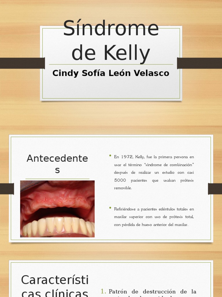 Síndrome de Kelly en Odontología | PDF | Hogar, jardinería y bricolaje