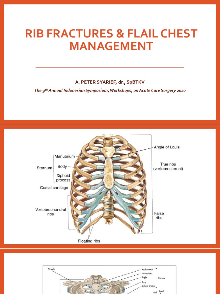 Rib Fractures and Flail Chest Management | PDF