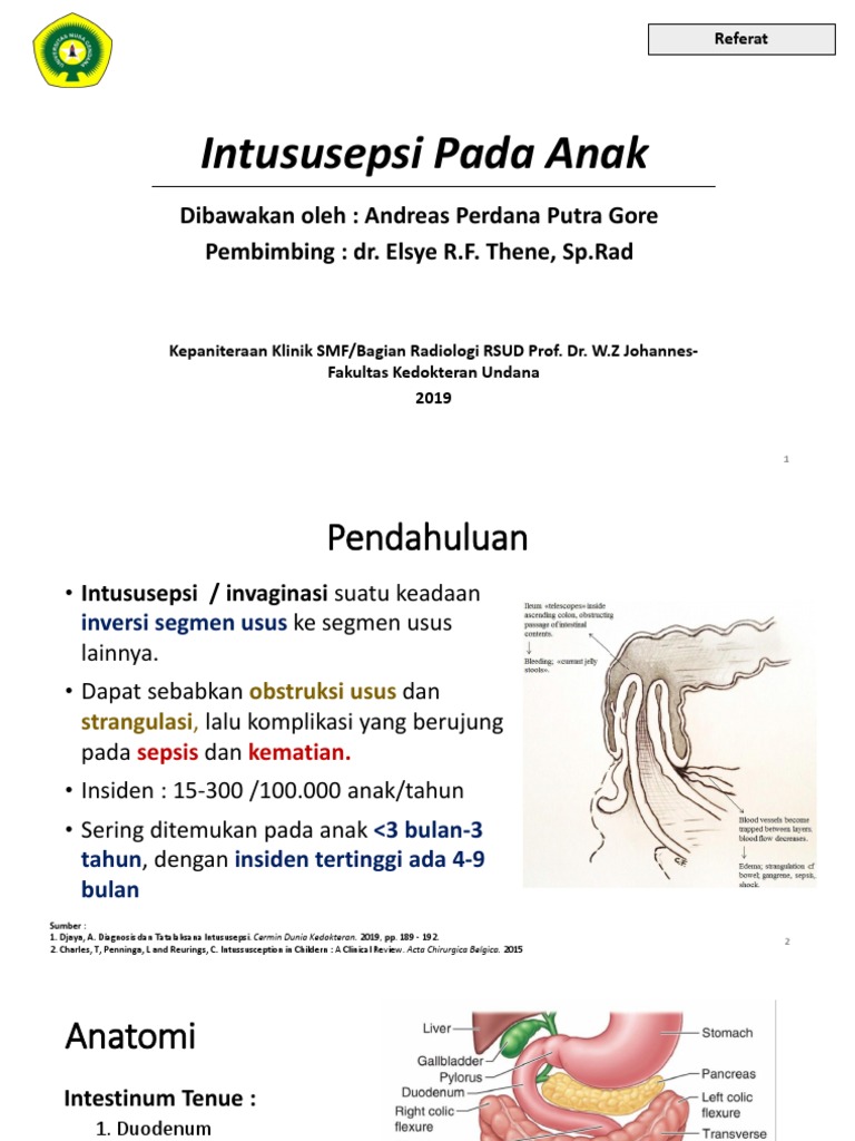 Slide Presentasi Intususepsi | PDF | Sains & Matematika