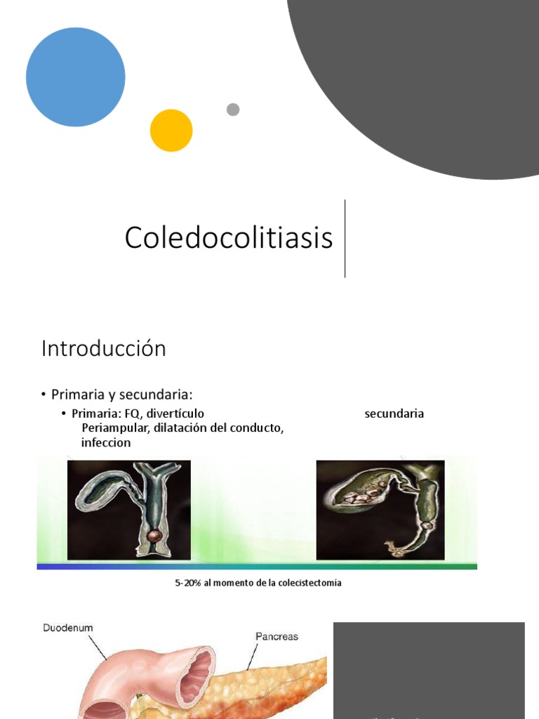 Coledocolitiasis | PDF