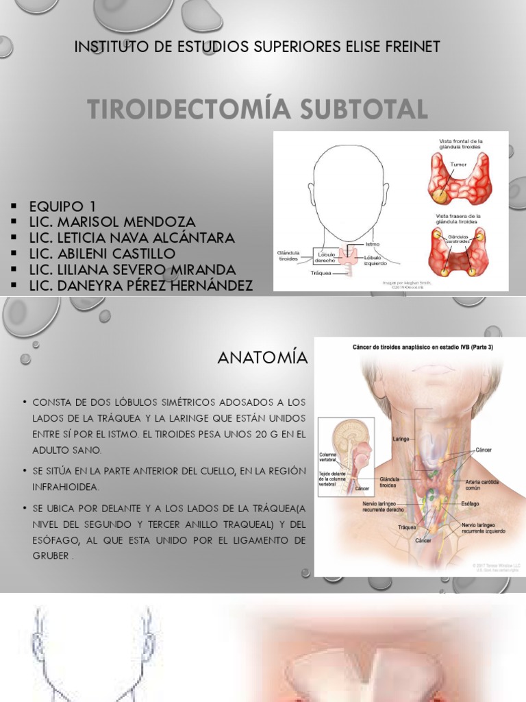 Tiroidectomia Subtotal | PDF