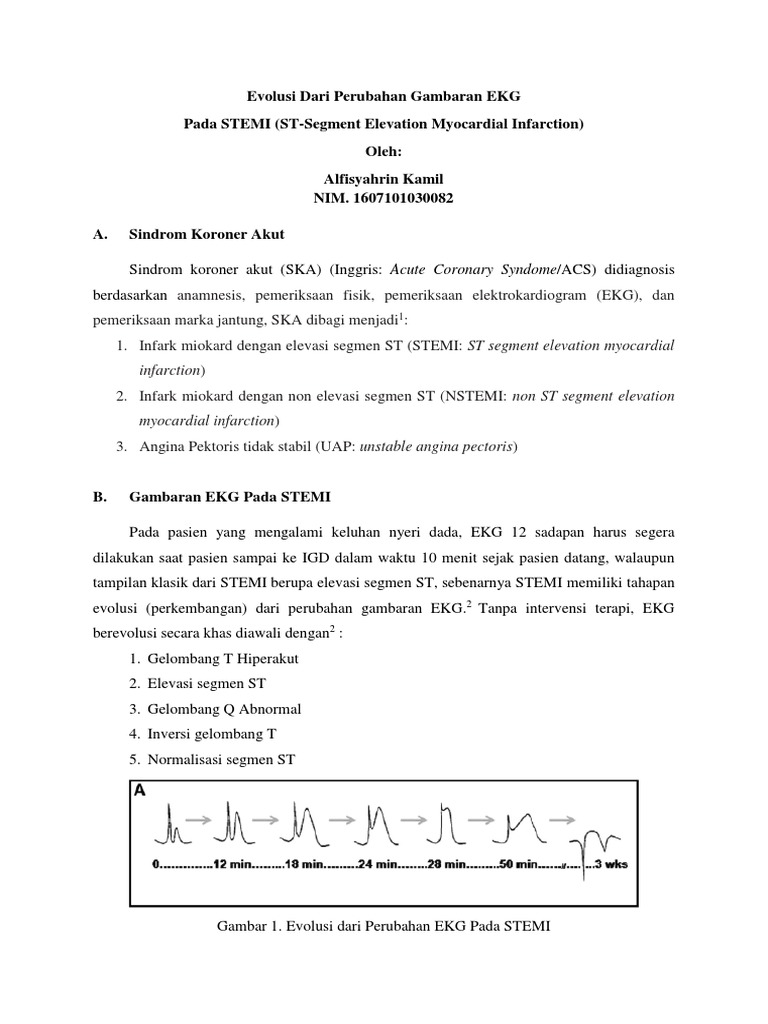 Evolusi Gambaran EKG pada STEMI: Tahapan Perkembangan Perubahan Elektrokardiogram pada Infark ...