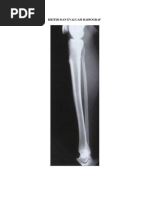 Pemeriksaan Radiografi Antebrachii | PDF