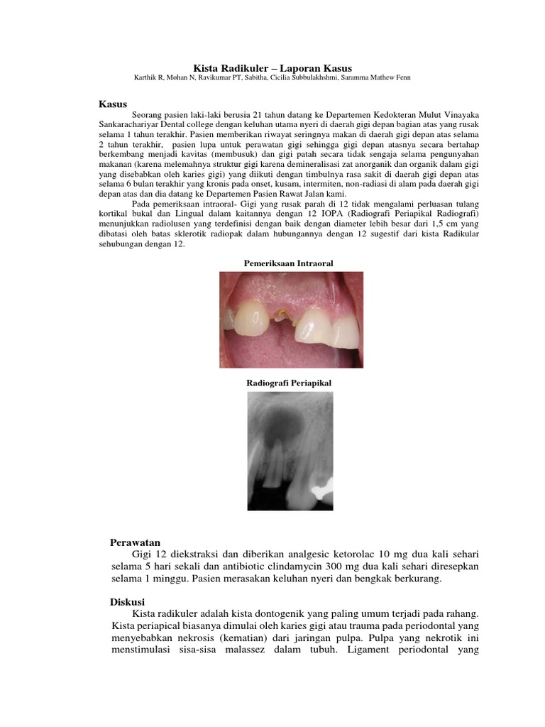 Kista Radikuler | PDF