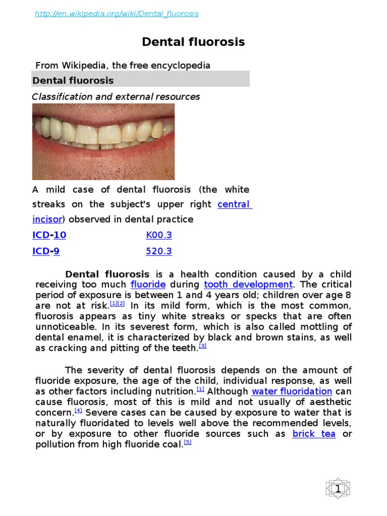 Dental Fluorosis | Dentistry | Mouth