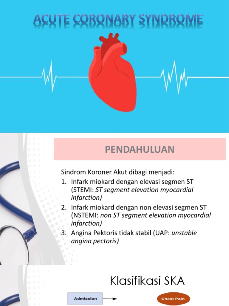 Stemi | PDF