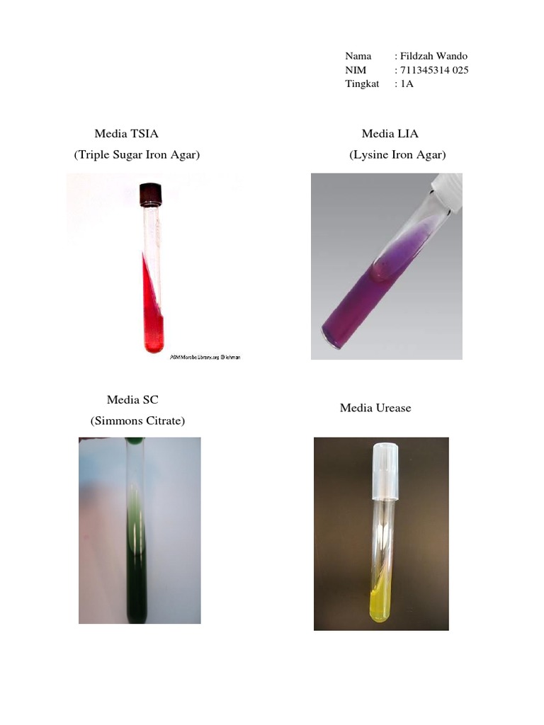 Tgs Media Uji Biokimia | PDF