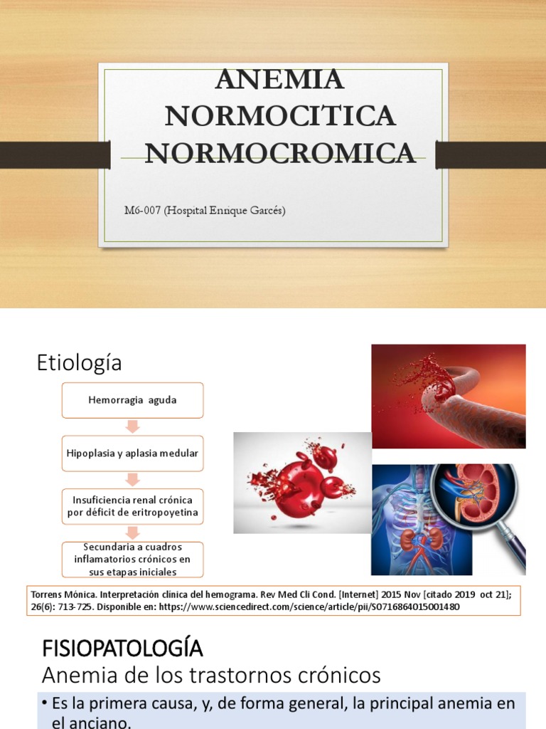 Anemia Normocítica Normocromática: Causas y Tratamiento | PDF