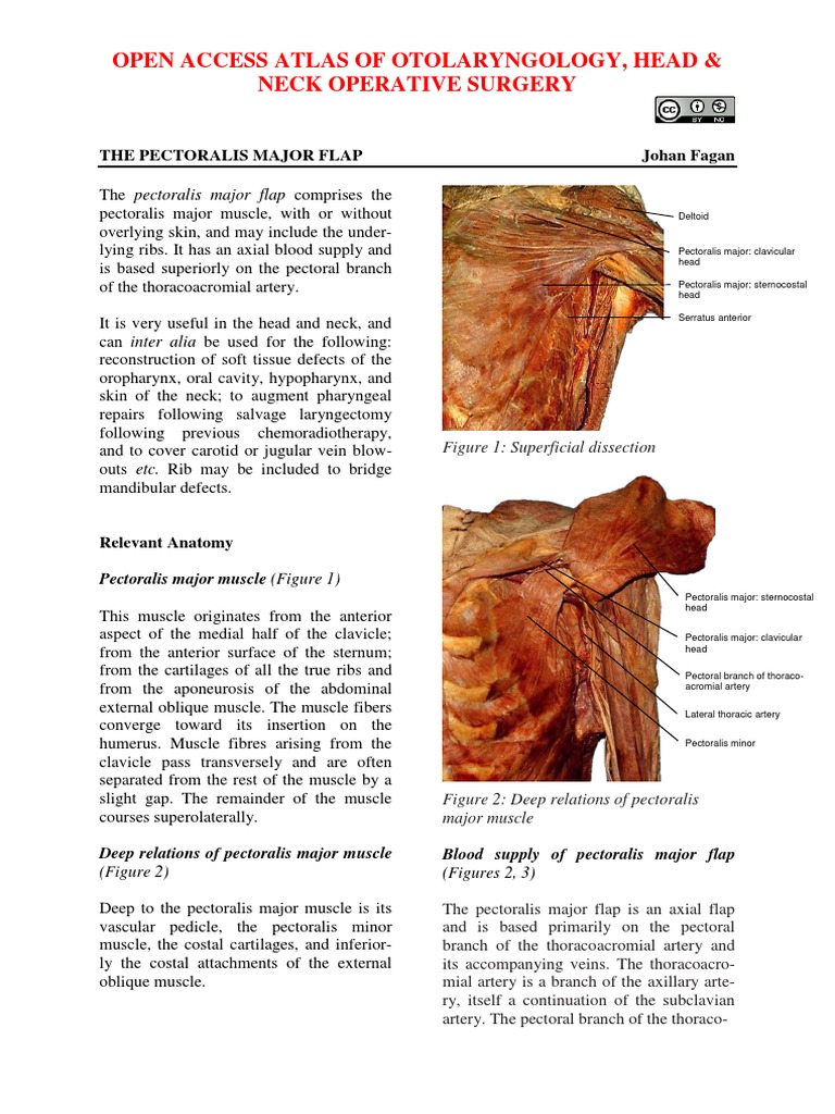 Pectoralis Major Flap-1