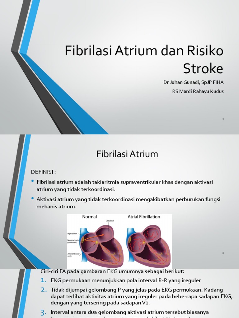 Atrial Fibrilasi Pada Stroke - Dr. Johan, SP - JP, FIHA | PDF | Sains ...