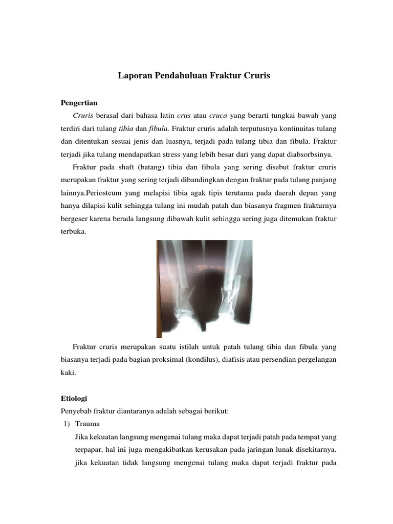 LP Fraktur Cruris | PDF