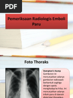Sindrom Obstruksi Pasca TB PDPI | PDF