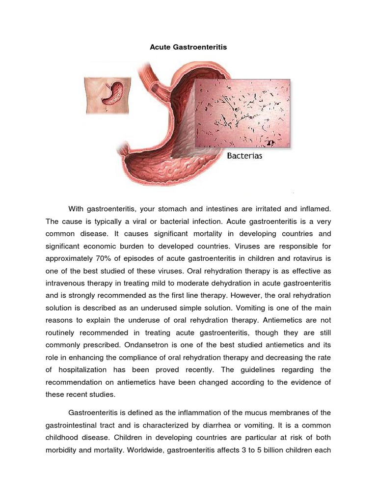Acute Gastroenteritis Case Study | PDF