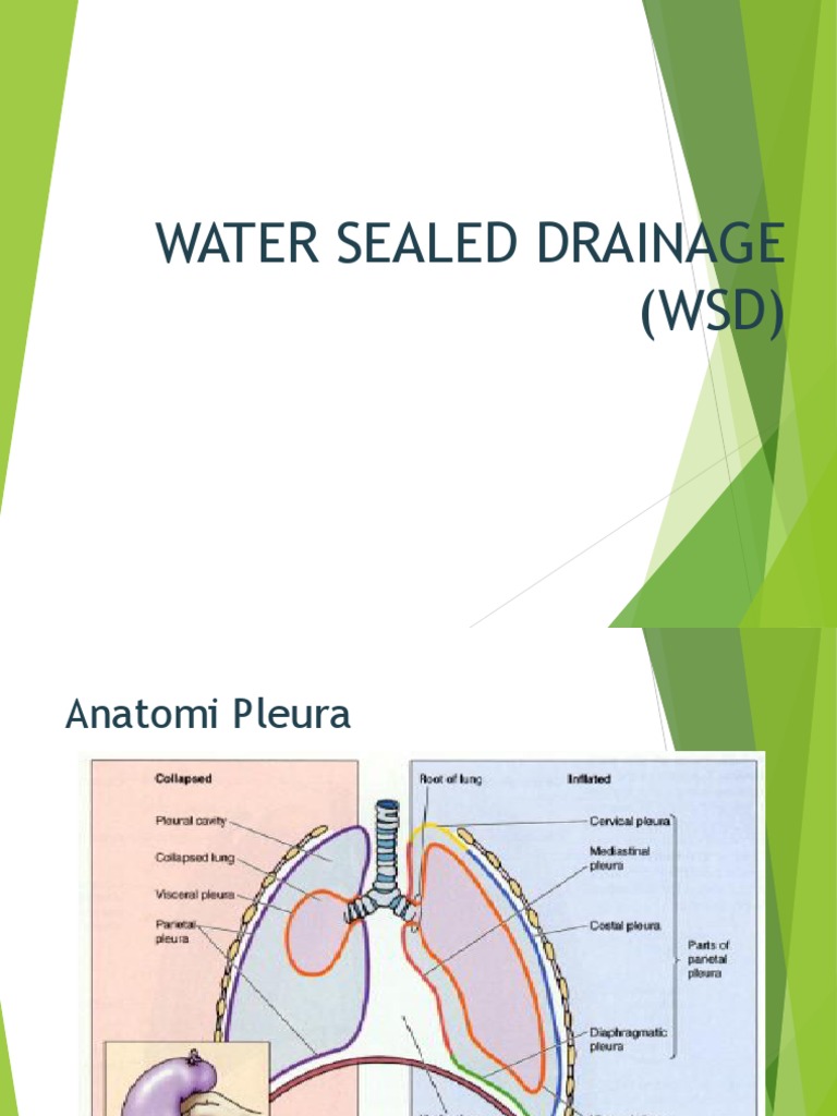 Water Sealed Drainage WSD | PDF