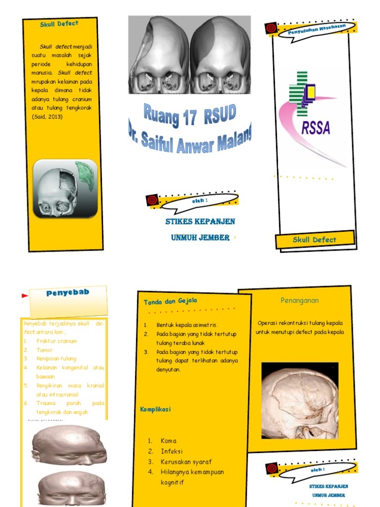 Leaflet Skull Defect | PDF