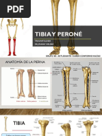 Fractur de Diafisis de La Tibia | PDF | Ct Scan | Hueso