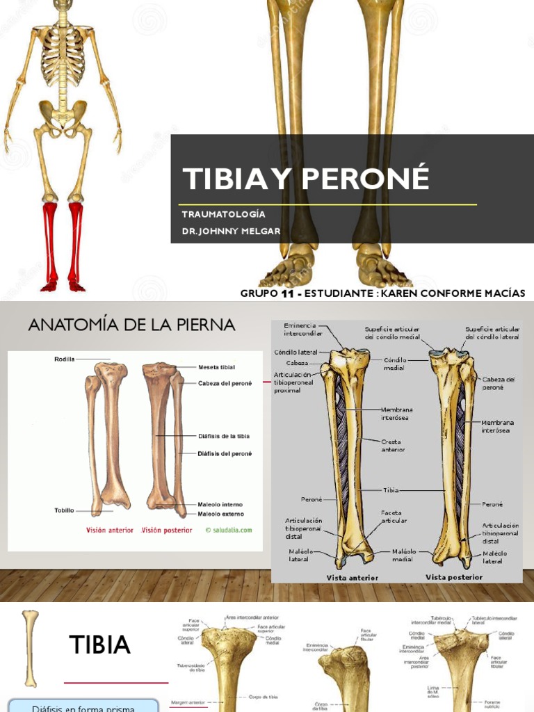 Fracturas de tibia y peroné | Rodilla | Traumatologia