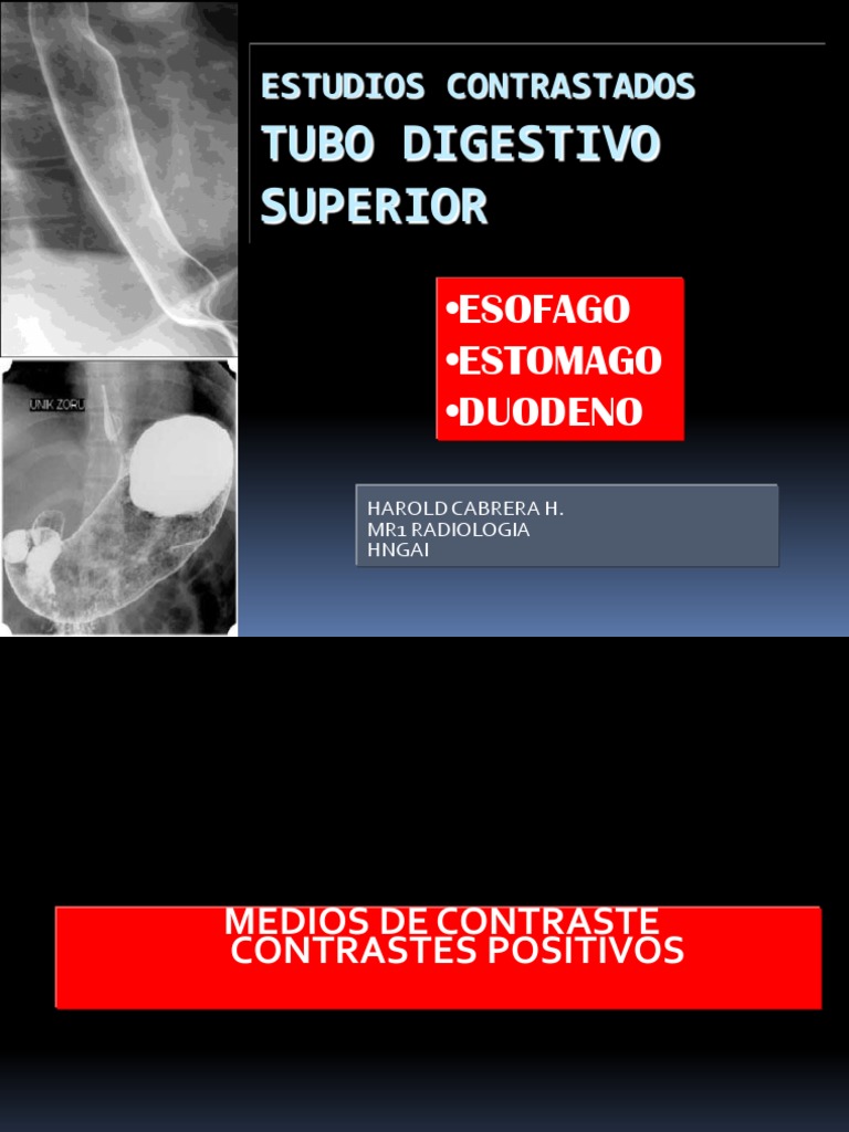 Estudios Contrastados del Tubo Digestivo | PDF | Estómago | Esófago