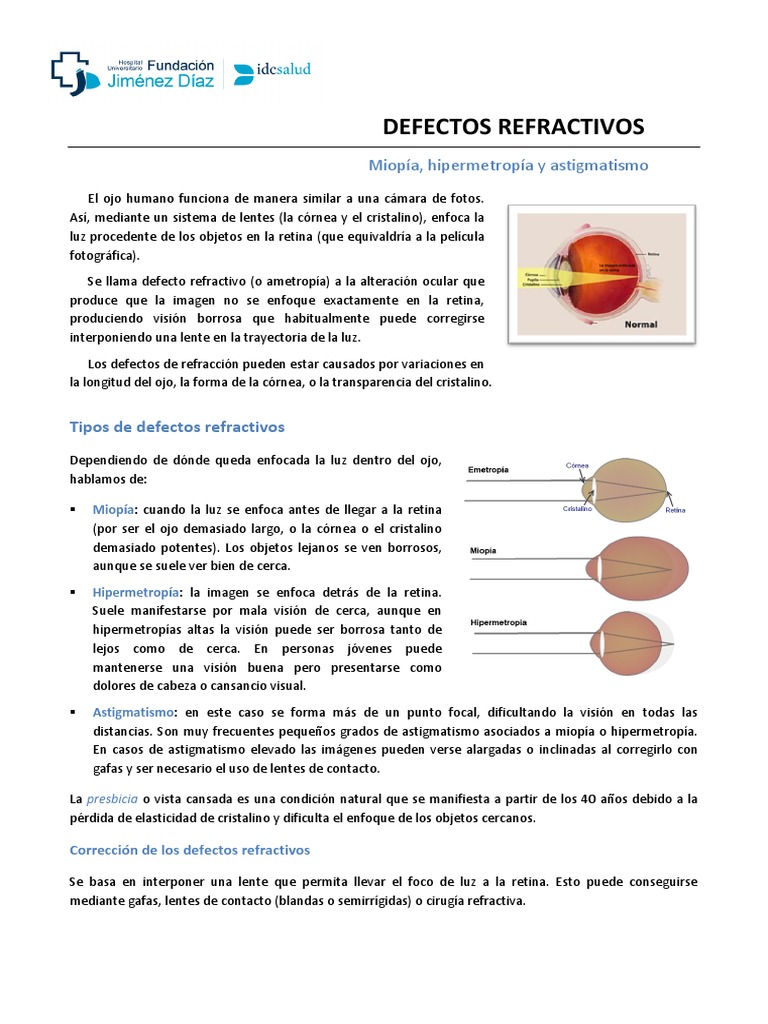 Defectos Refractivos: Miopía, Hipermetropía y Astigmatismo | PDF ...