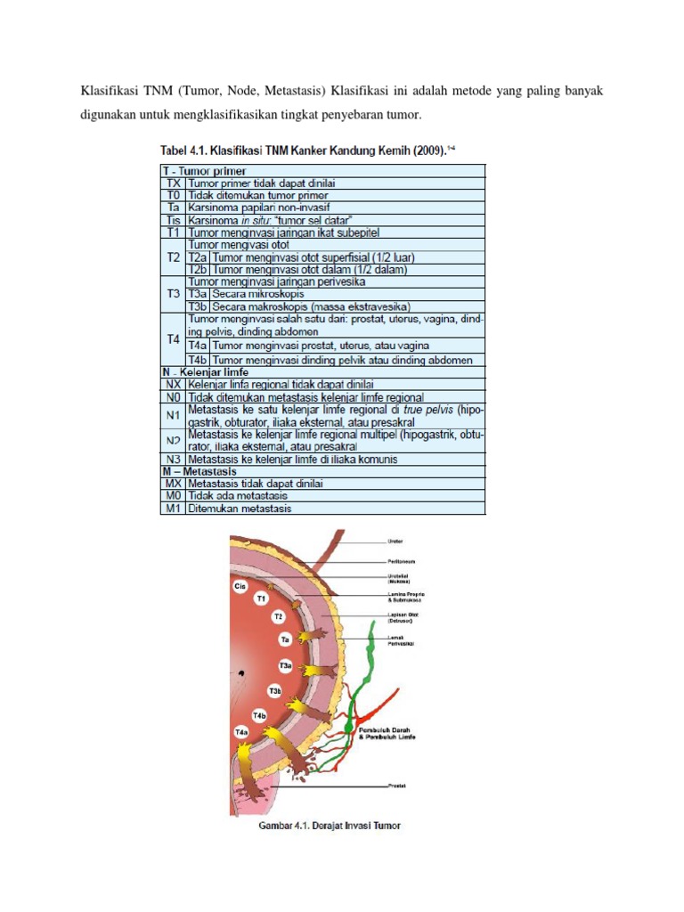 Karsinoma Buli | PDF