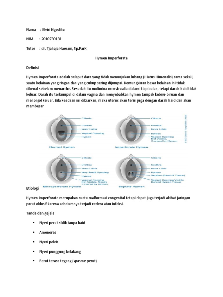Dokumen - Tips - Hymen Imperforata Word | PDF