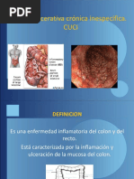 CUCI - Vs - Crohn CUADRO Comparativo para Diferencial | PDF | Colitis ...
