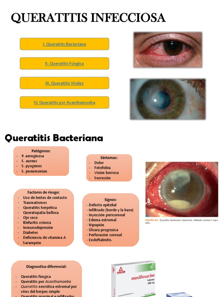 Queratitis Infecciosa | PDF