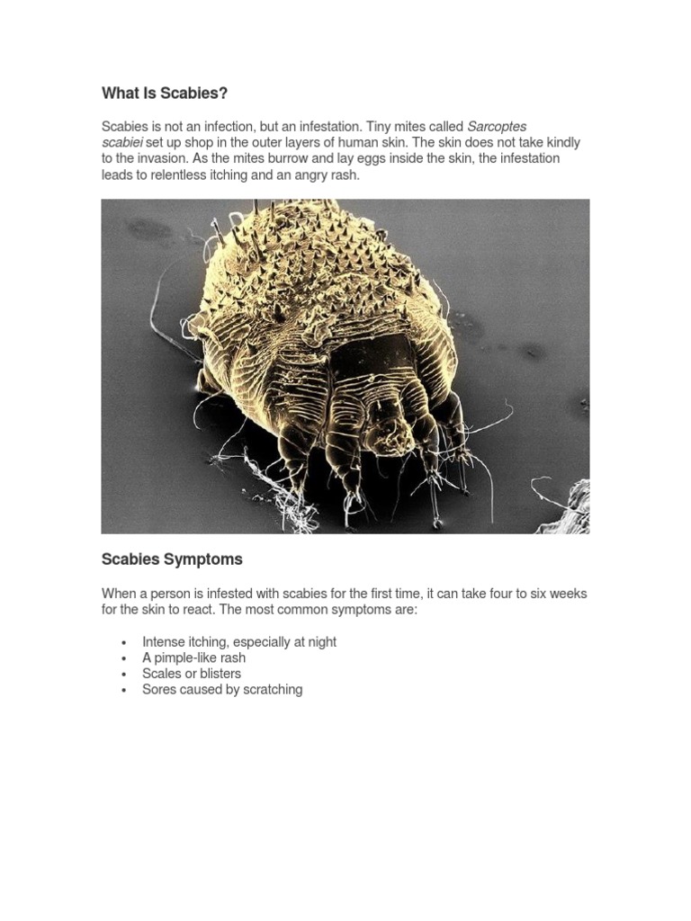 What Is Scabies | PDF | Skin | Medical Specialties