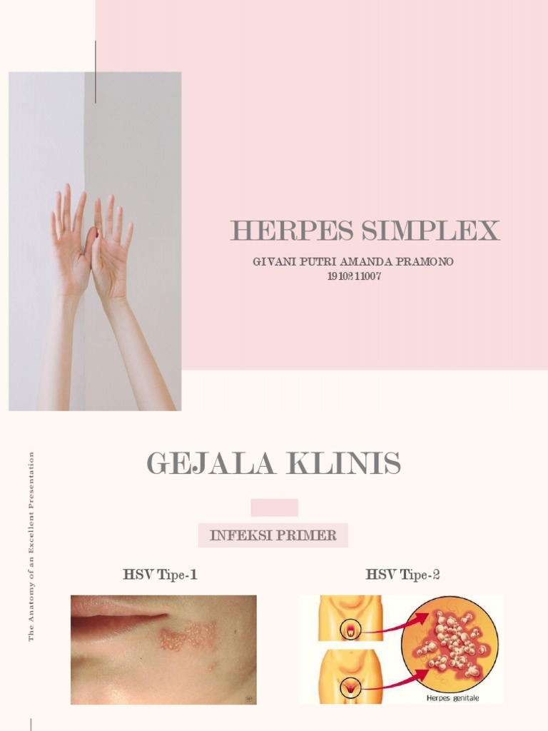 Herpes Simplex | PDF | Kesehatan Holistik