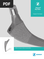 Exeter V40: Femoral Stem Using Exeter Broach | PDF | Surgery | Clinical ...