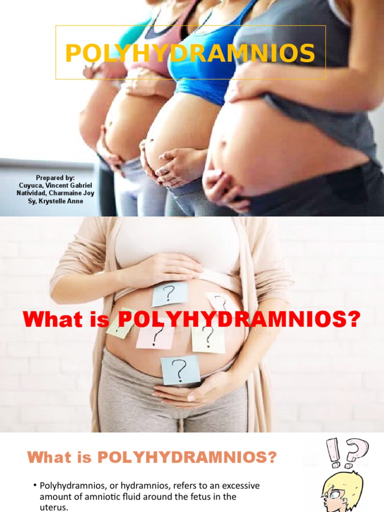 Polyhydramnios: Causes and Management | PDF | Science & Mathematics