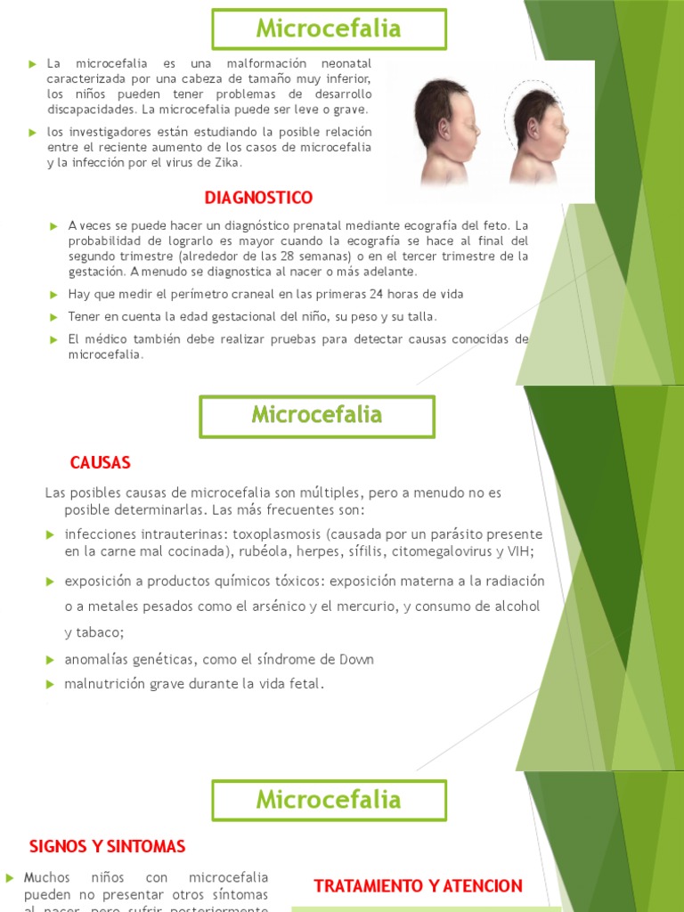 Microcefalia: causas, síntomas y tratamiento | PDF