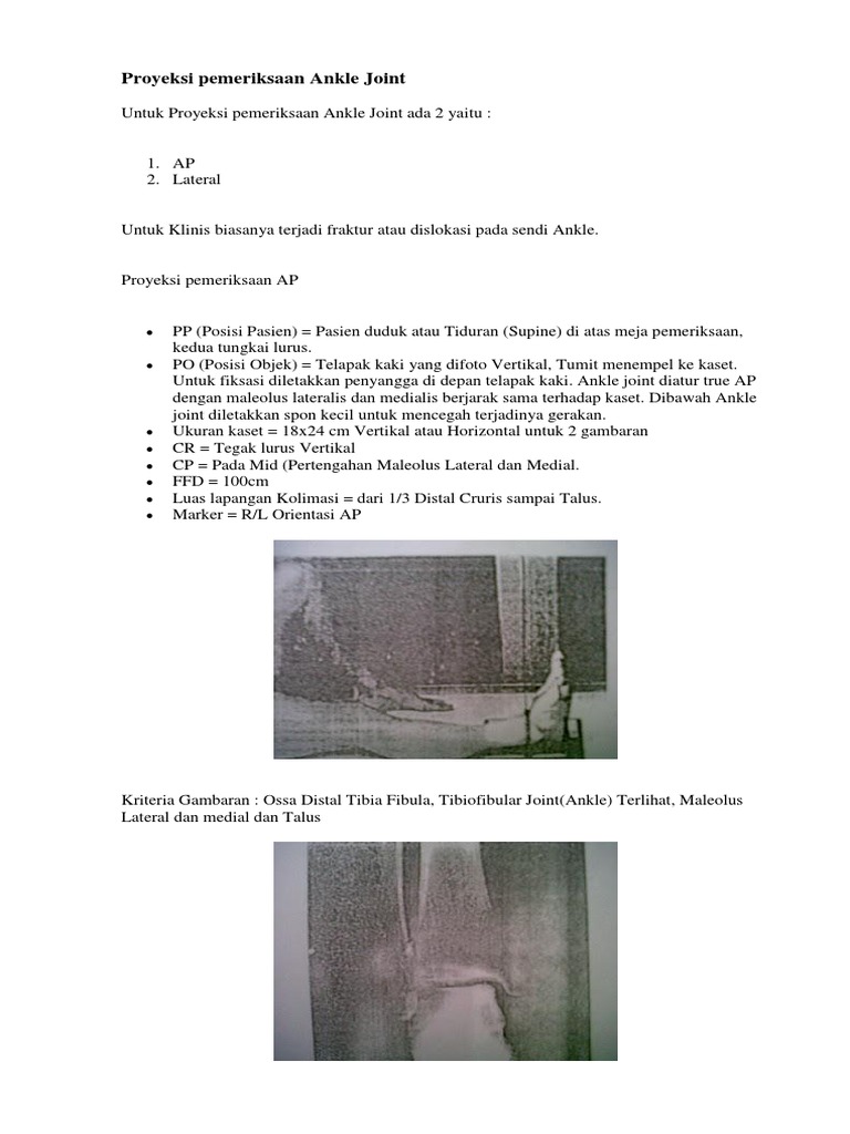 Proyeksi Pemeriksaan Ankle Joint AP dan Lateral | PDF