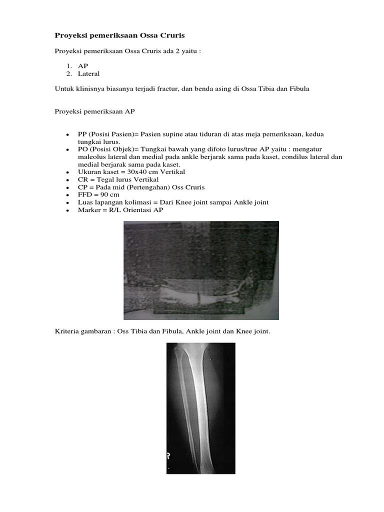 Proyeksi Rontgen Ossa Cruris AP dan Lateral | PDF