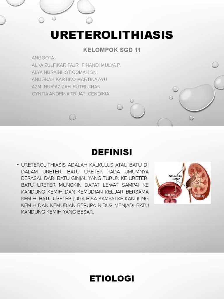 SGD 11 - Ureterolithiasis | PDF