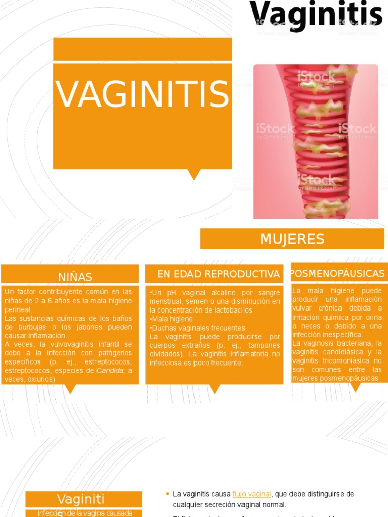 Vaginosis, Vaginitis y Vaginismo | PDF | Rtt | Sistema Reproductor Femenino Mamífero