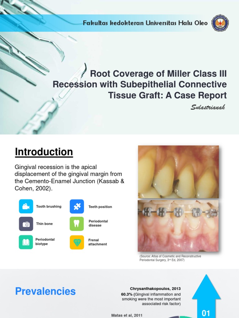 Resesi Miller Klas Iii | PDF | Periodontology | Health Care