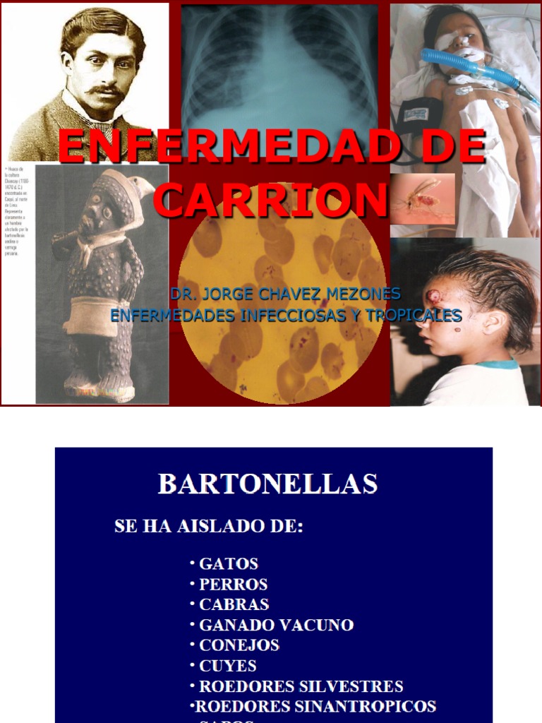 Enf de Carrion | PDF | Fiebre | Patologia clinica