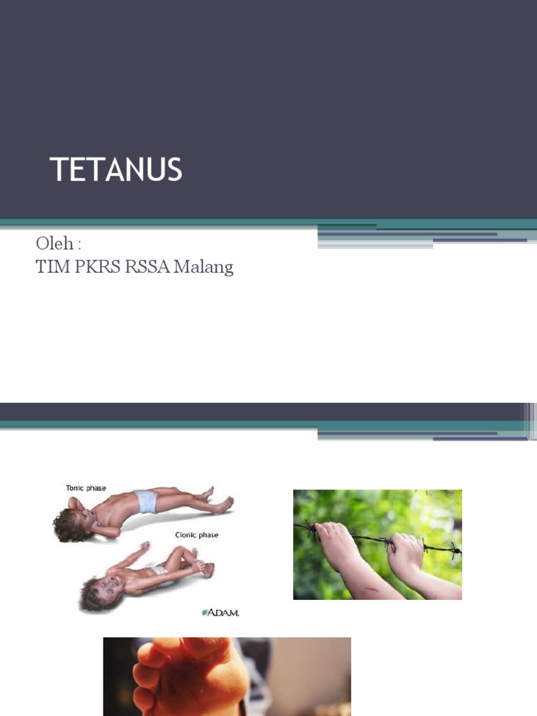 Tetanus | PDF