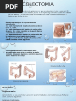 Instrumental Quirurgico Apendicectomía Final | PDF | Cirugía ...