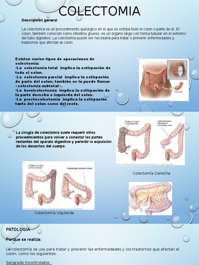 COLECTOMIA | PDF | Hogar, jardinería y bricolaje | Salud y bienestar