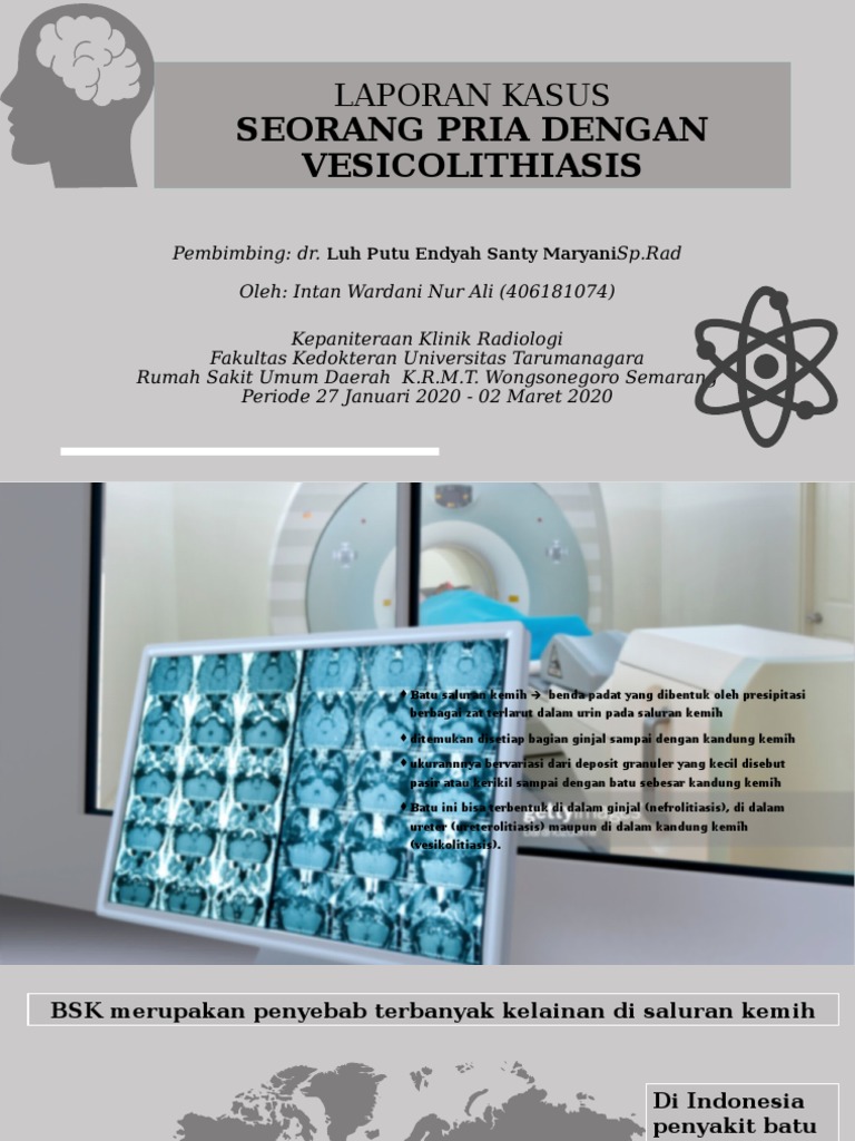 Laporan Kasus Vesikolithiasis Nefrolithiasis RSWN RADIO | PDF