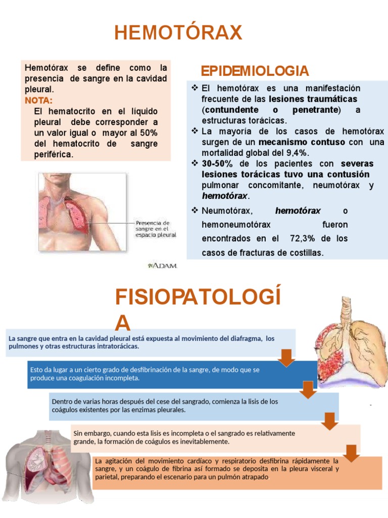 HEMOTORAX | PDF | Pulmón | Emergencias Médicas