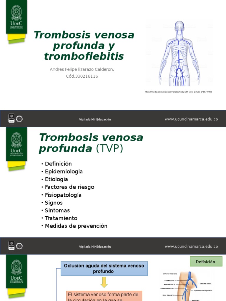 Trombosis Venosa Profunda y Trombo-Flebitis | PDF | Trombo | Epidemiología