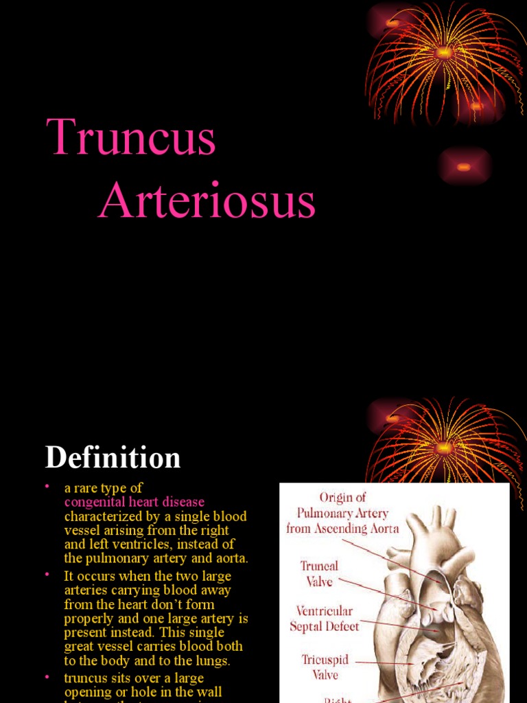 Truncus Arteriosus | Artery | Cardiology