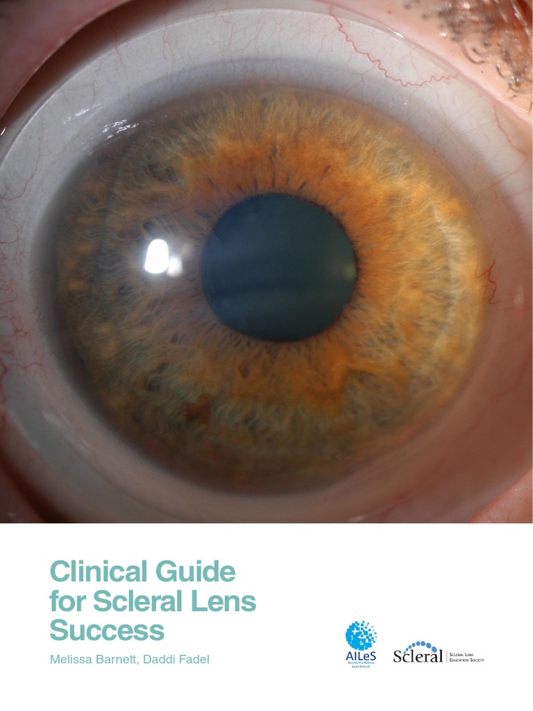 Scleral Fitting | PDF | Cornea | Contact Lens