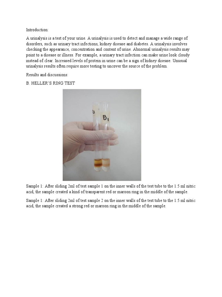 7B Heller's Ring Test | PDF | Urine | Urinary System